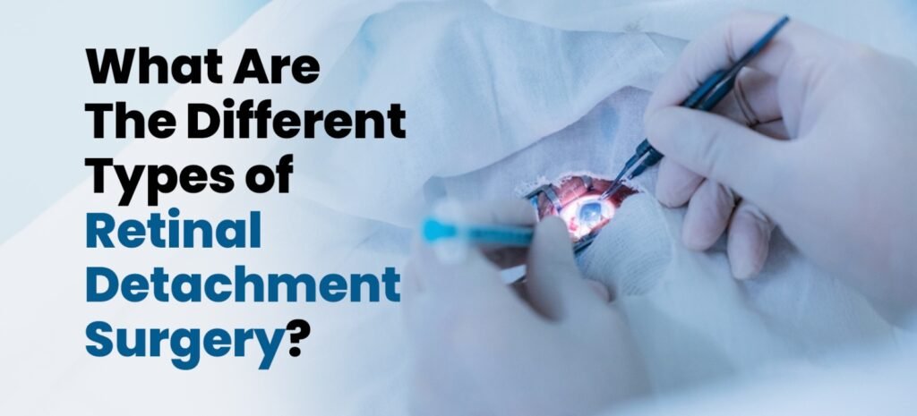 What Are the Different Types of Retinal Detachment Surgery? | Eyeheal